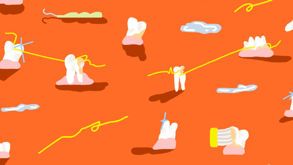 Récession gingivale : traitement, causes, symptômes - CHD