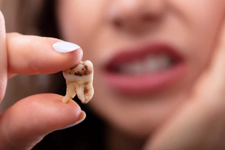 Gappy Teeth or Diastema: Should You Keep It or Correct It?