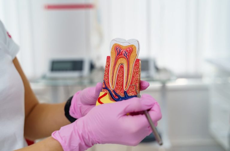 Endodontics: Everything You Need to Know ! - CHD